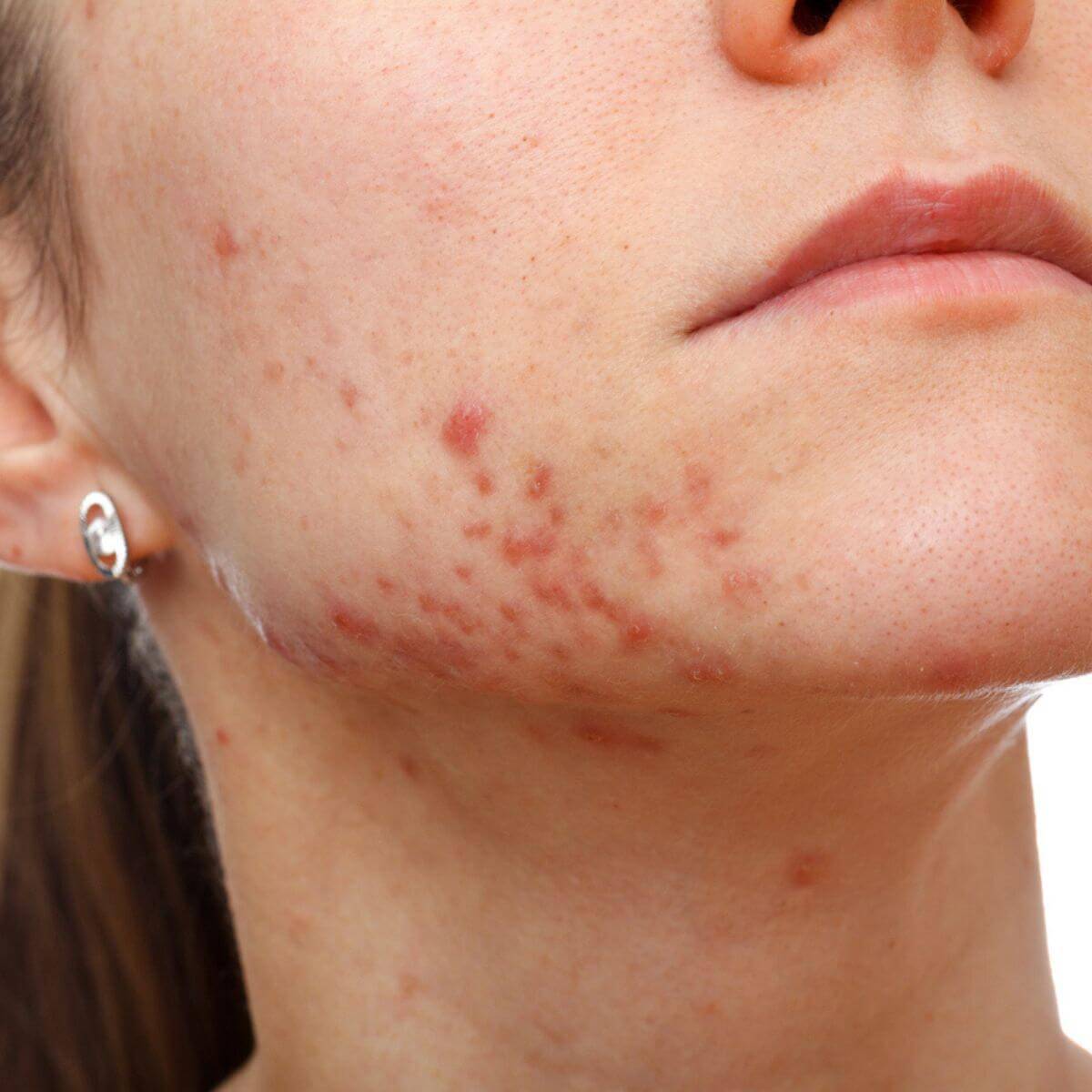 Simple Solution For Unlocking Radiant Glowing Clear Skin